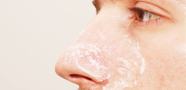 Komedo di Muka Emang Ngeselin. 7 Masker Sederhana Ini Bikin Komedo ...