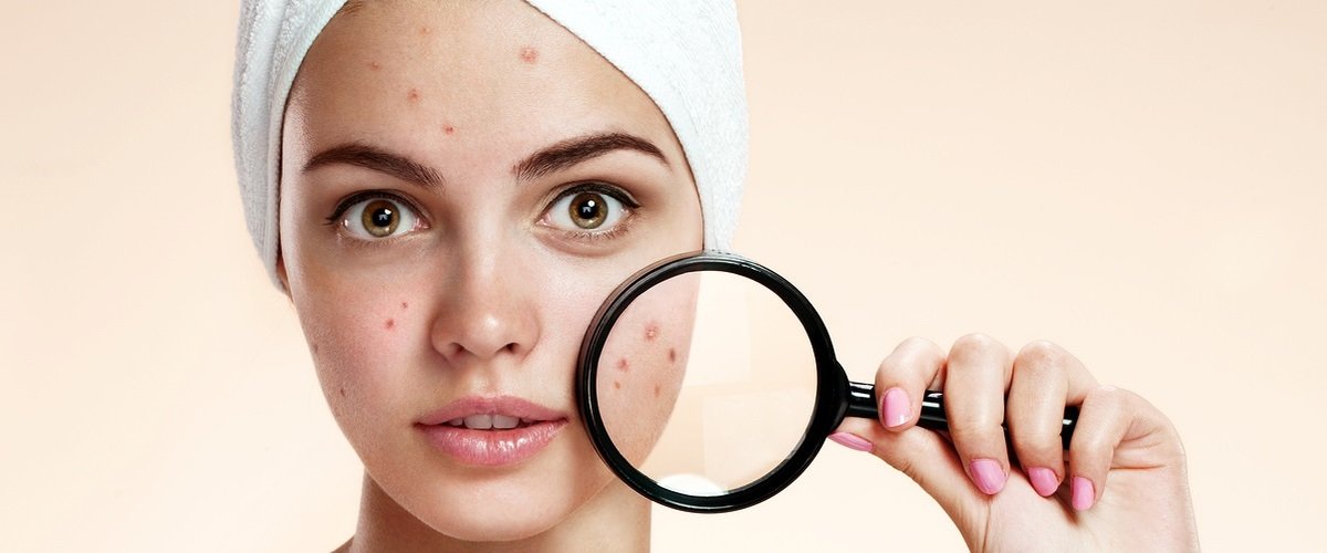 Yuk, Tetap Percaya Diri Meski Jerawatan!
