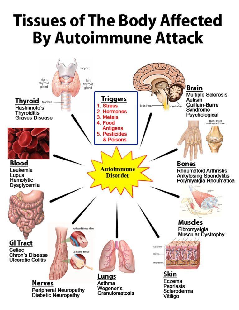 Lebih Akrab Sama Penyakit Lupus; 'Momok' yang Lebih Banyak Menyerang ...