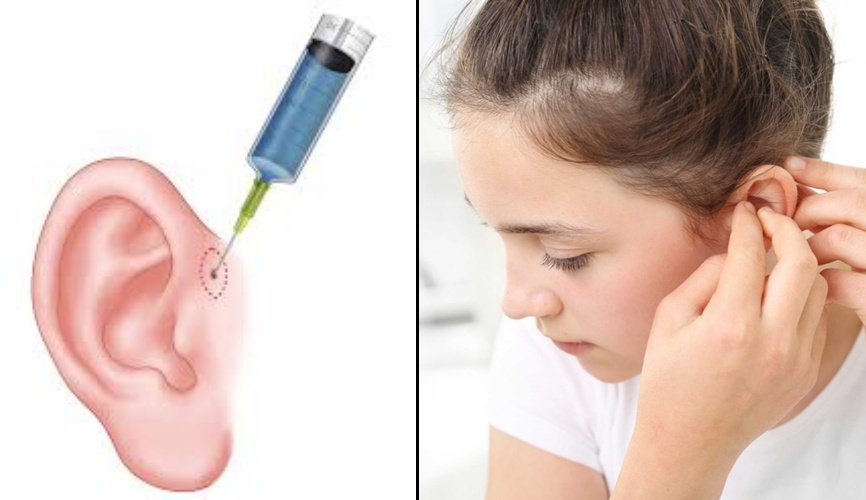 Tentang Infeksi Sinus Preauricular yang Diderita Anak Anji, dan ...