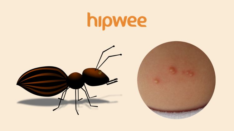 11 Tipe Bekas Gigitan Serangga yang Ada di Sekitar Kita. Biar Lebih ...