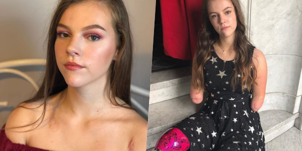 Tanpa Tangan dan Kaki, Beauty Vlogger Ini Mampu Pukau Semua Orang ...