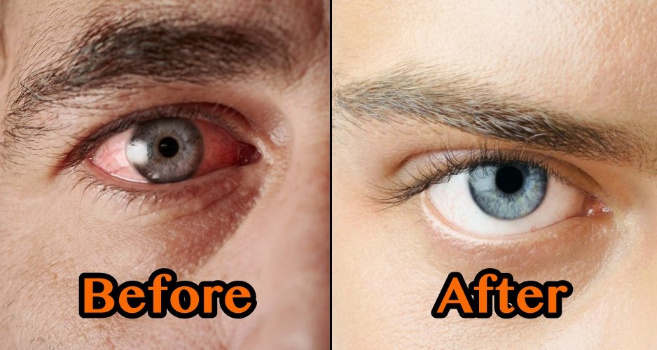 Begini Penampakan Fisik Sebelum dan Sesudah Berhenti Merokok. Kentara ...