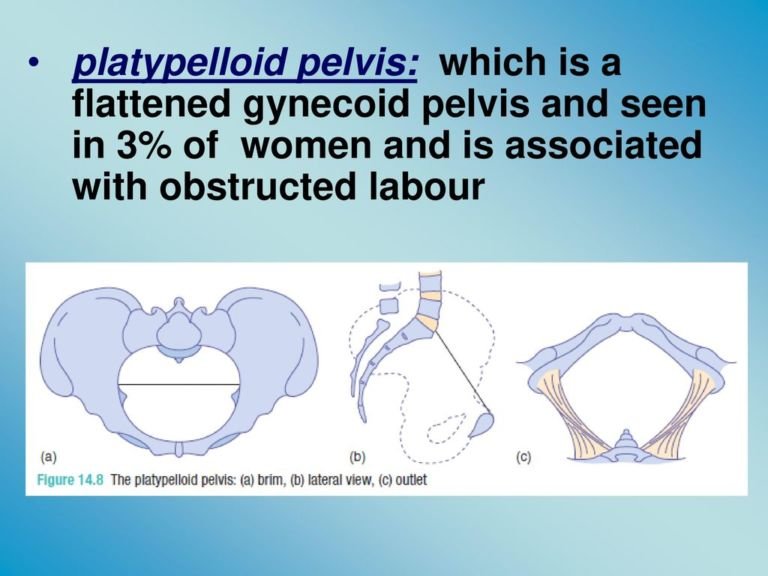4 Bentuk Panggul Wanita yang Memengaruhi Proses Persalinan. Bukan ...