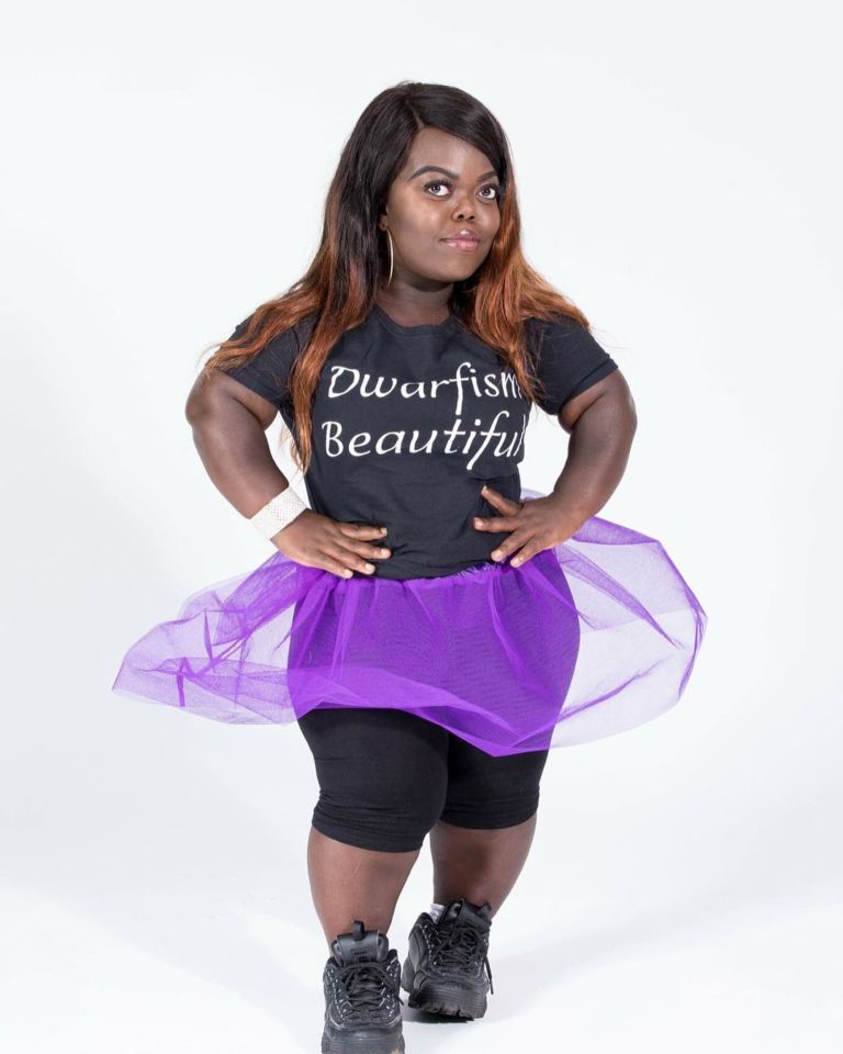 Model Penyandang Dwarfisme Ini Membuktikan Badan Kerdil Tak Harus ...