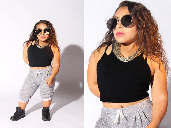 Model Penyandang Dwarfisme Ini Membuktikan Badan Kerdil Tak Harus ...