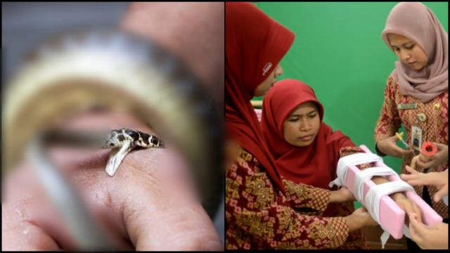 4 Cara yang Benar untuk Menangani Luka Gigitan Ular. Kalau Keliru ...