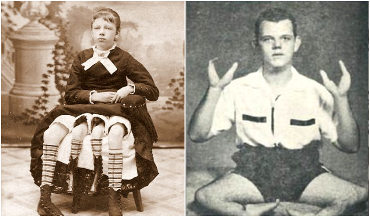 5 Penyandang Disabilitas yang Dijadikan Tontonan Sirkus. Potret Betapa ...