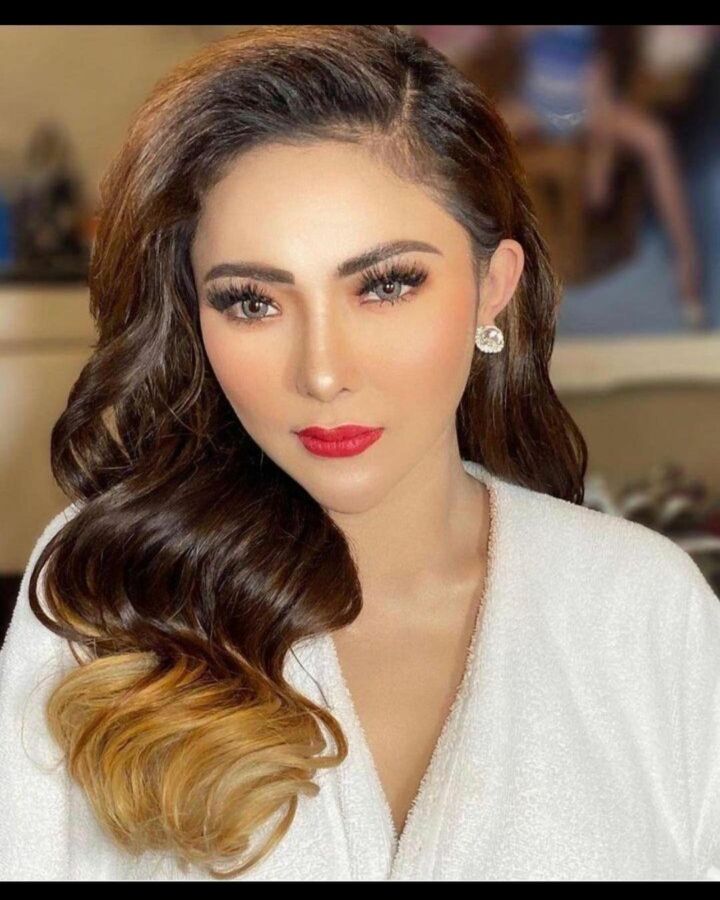Selain Melaney Ricardo, 6 Artis Indonesia ini Juga Lakukan Operasi ...
